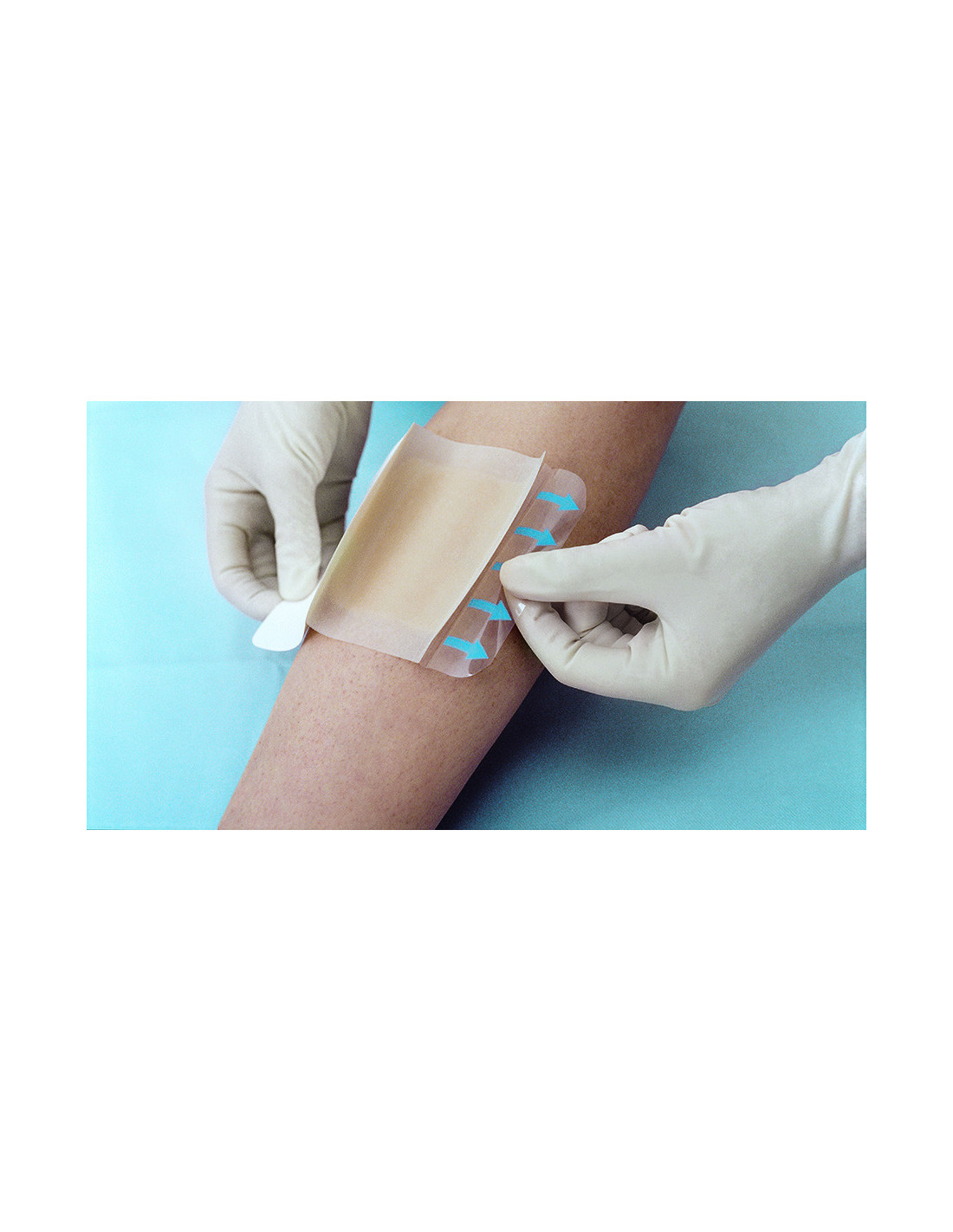 HYDROCOLL Pansament cu hidrocoloid, Hartmann
